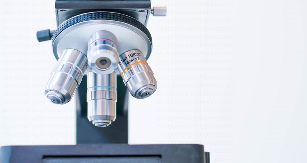 Tendon Xanthoma - Xanthelasma