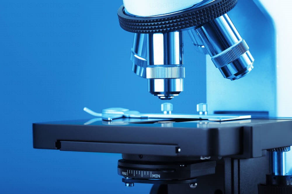 Tendon Xanthomata - Xanthelasma